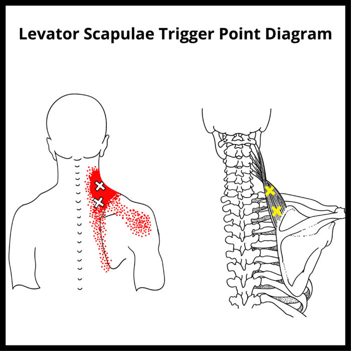 Levator Scapulae Trigger Point Diagram, Trigger Point Diagrams | オアシス整骨院
